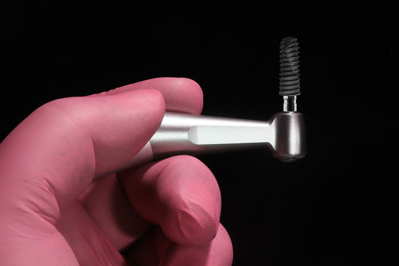 Unlocking the Mysteries of Dental Implants in Colleyville, TX - Texas ...